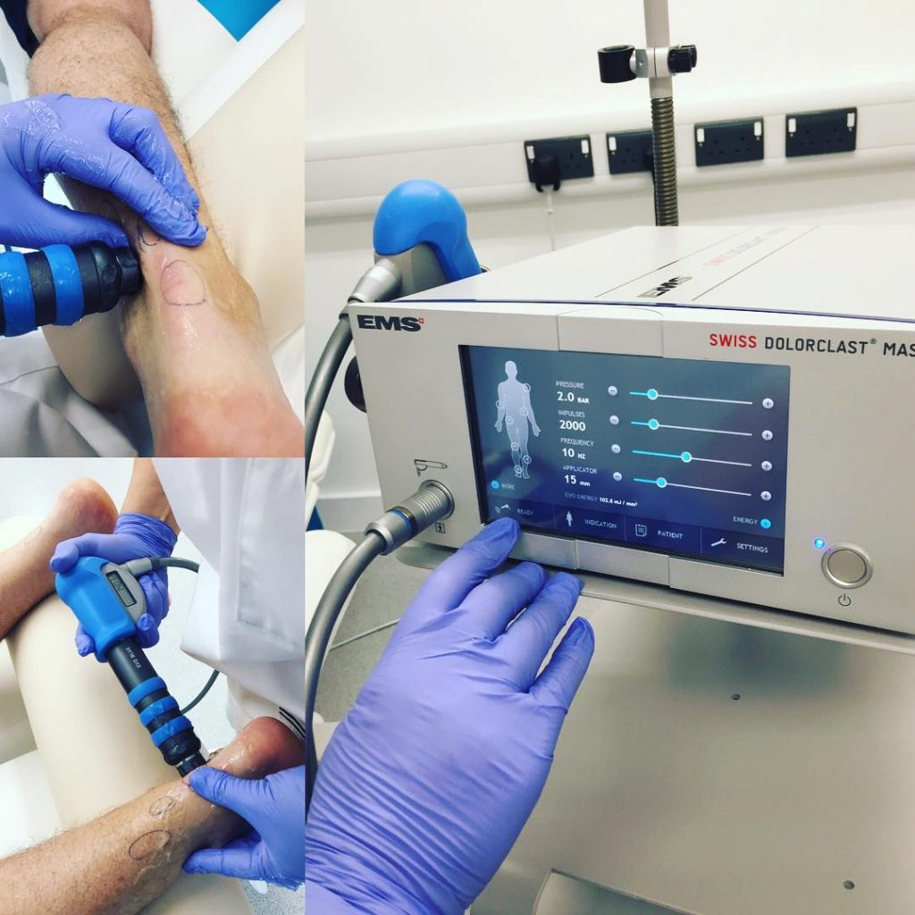 What Is Shockwave Therapy? | PhysioCentral